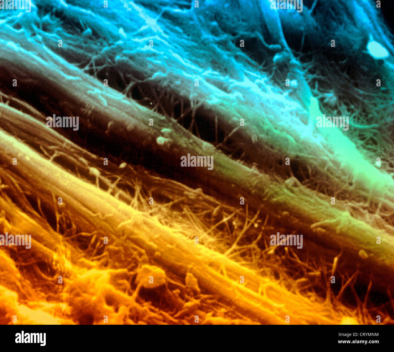Alveoli micrograph hi-res stock photography and images - Alamy