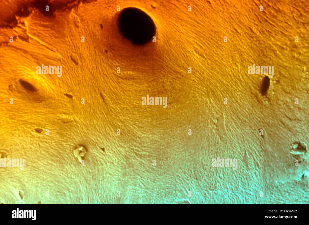 Alveoli micrograph hi-res stock photography and images - Alamy