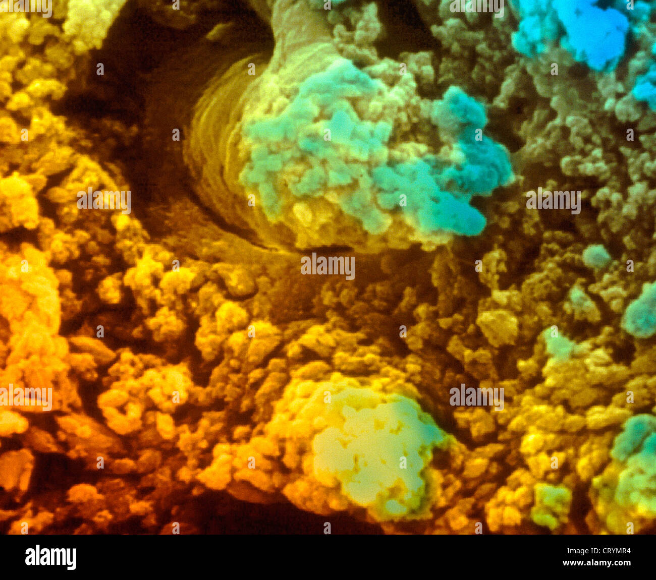 Alveoli micrograph hi-res stock photography and images - Alamy