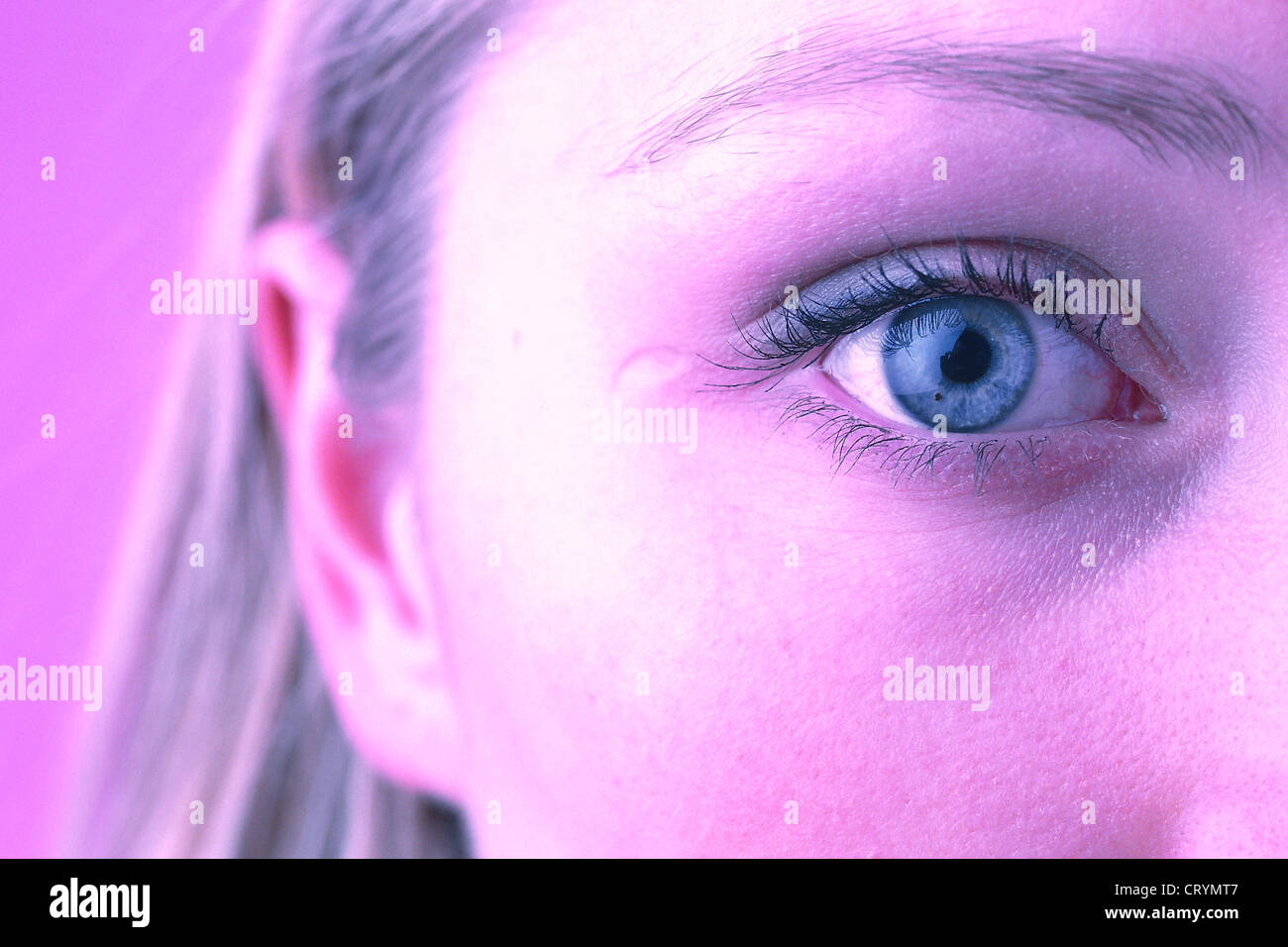 Iris scars hi-res stock photography and images - Alamy