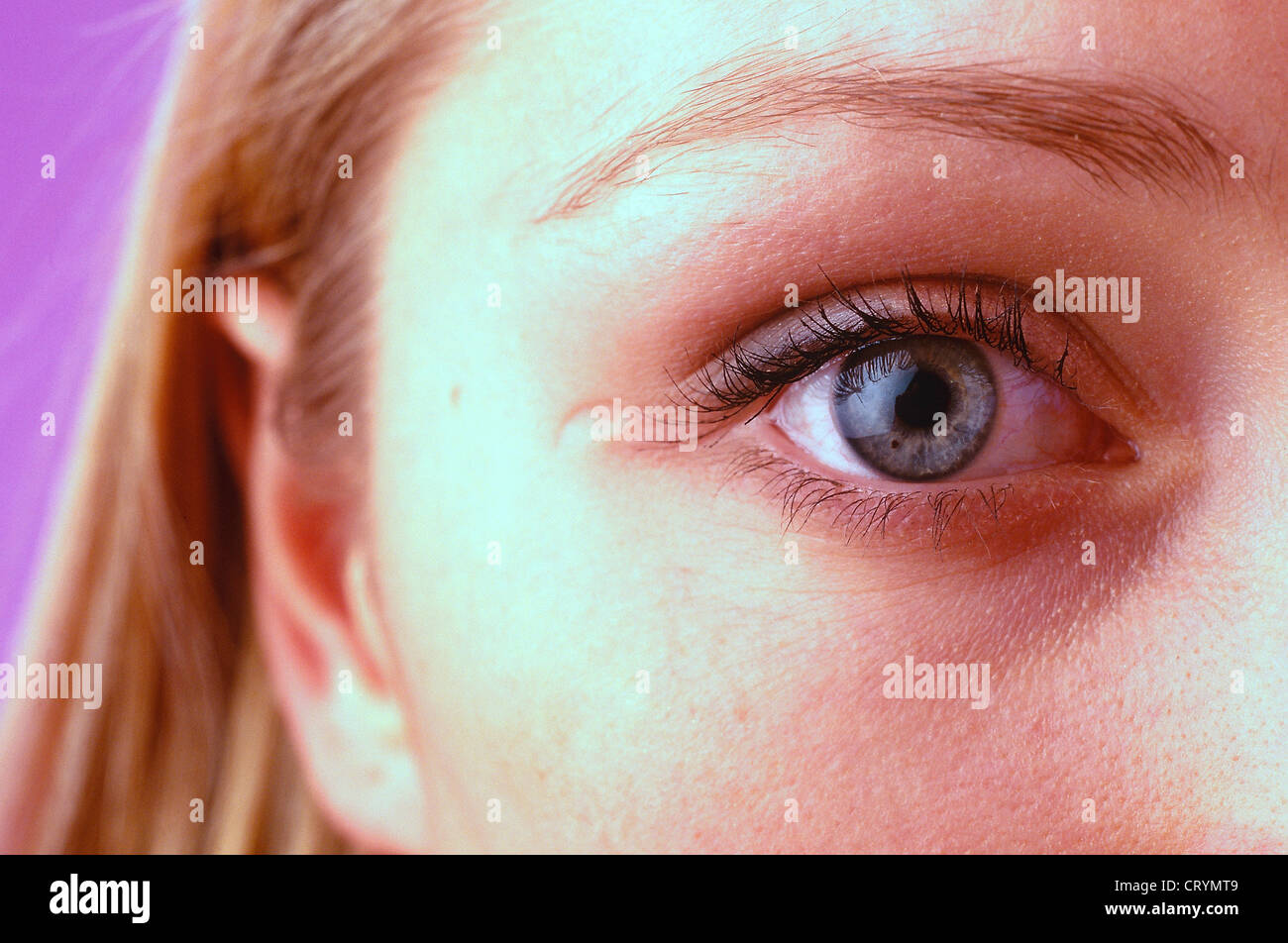 Iris scars hi-res stock photography and images - Alamy