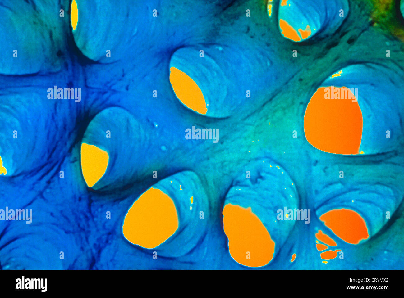 Dentin micrograph hi-res stock photography and images - Alamy