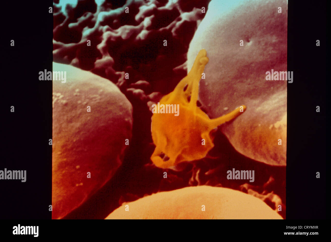 Blood cells and platelets micrograph hi-res stock photography and ...