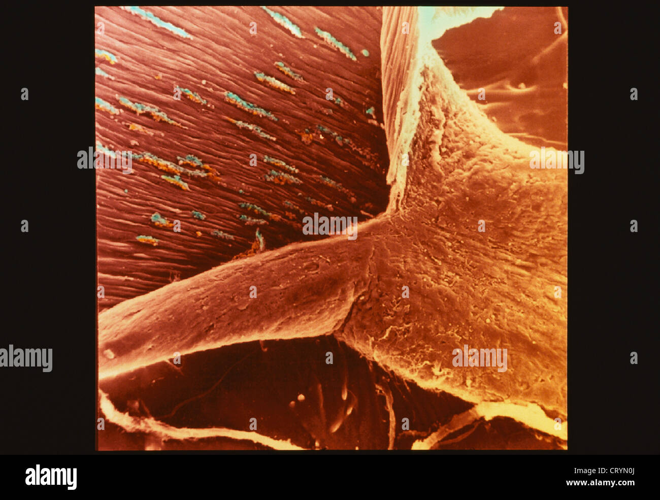 Micrograph Blood Capillary High Resolution Stock Photography and Images ...