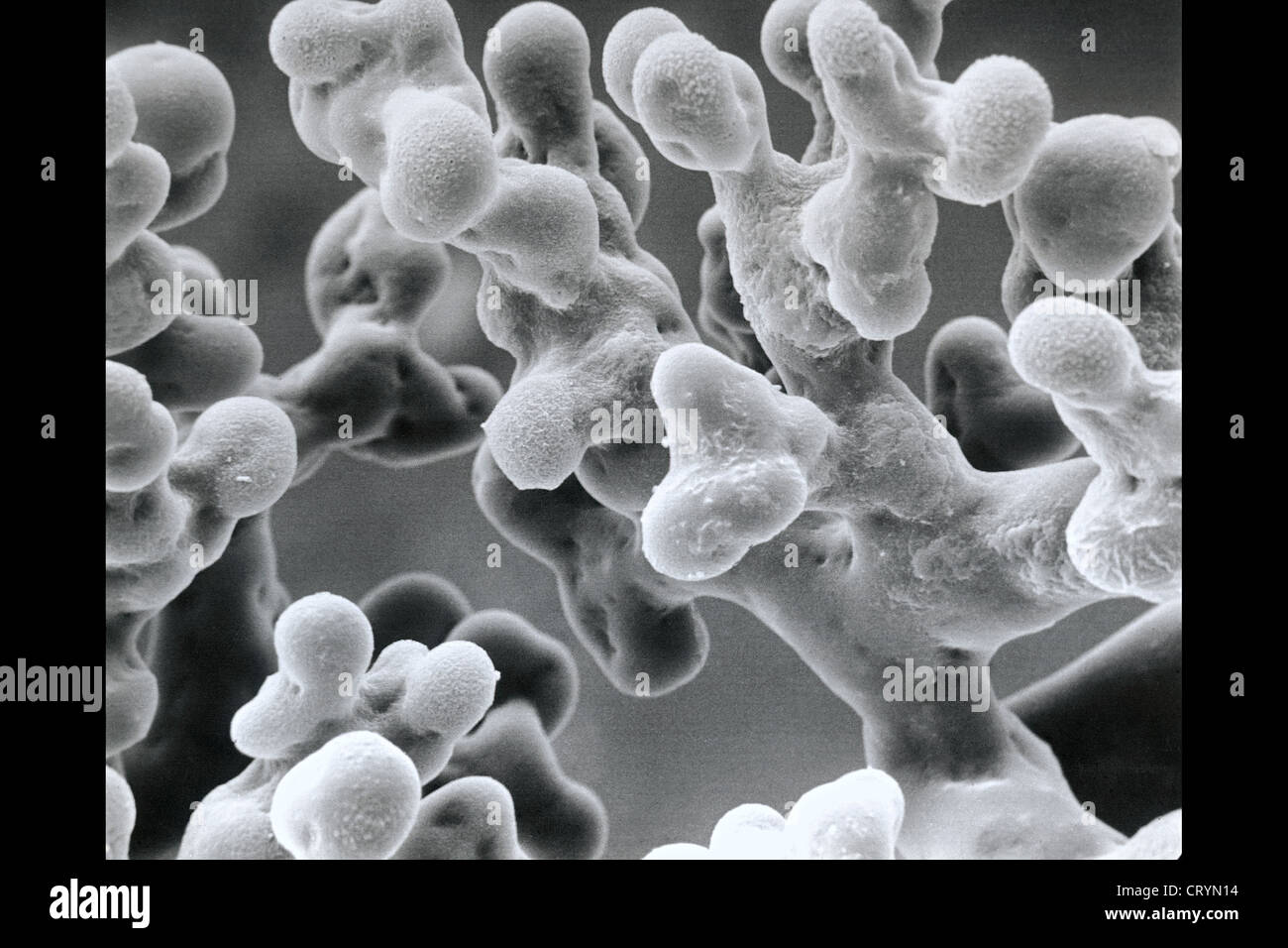 Alveoli of lungs microscope hi-res stock photography and images - Alamy