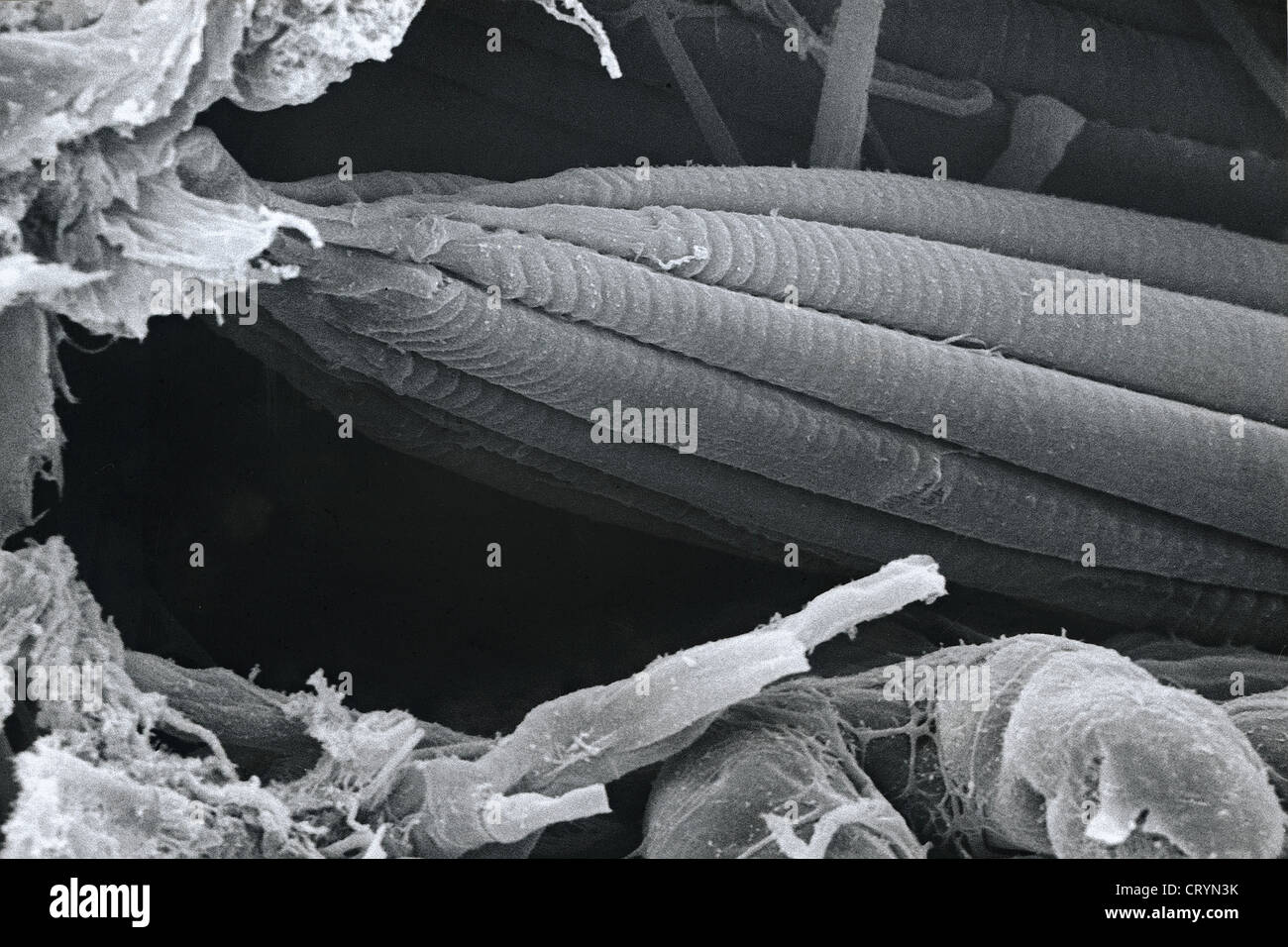 Scanning electron microscope fibre hi-res stock photography and images ...