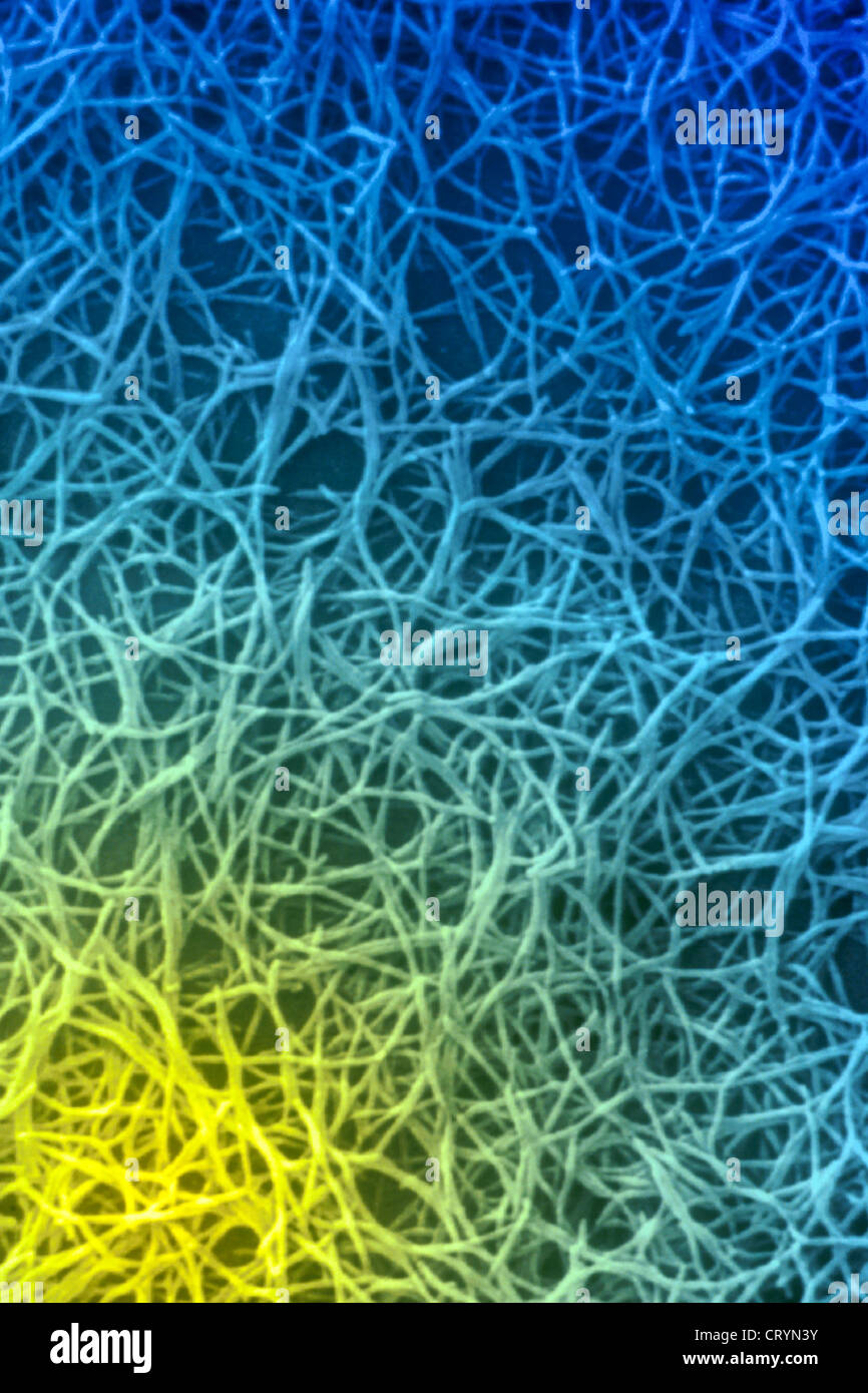 Fusobacterium hi-res stock photography and images - Alamy