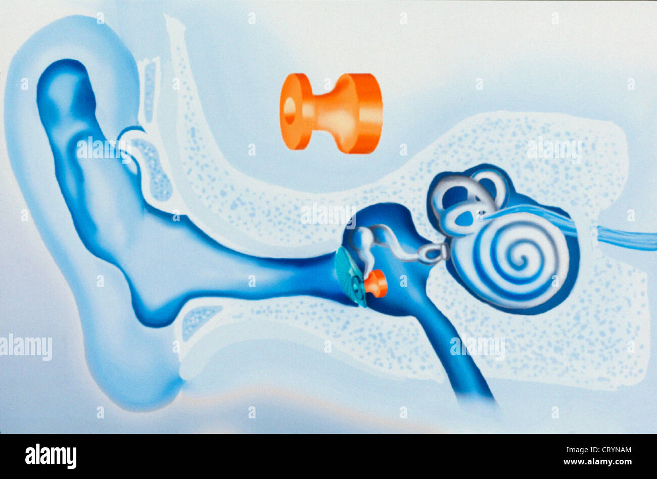 TREATMENT OF OTITIS, DRAWING Stock Photo - Alamy