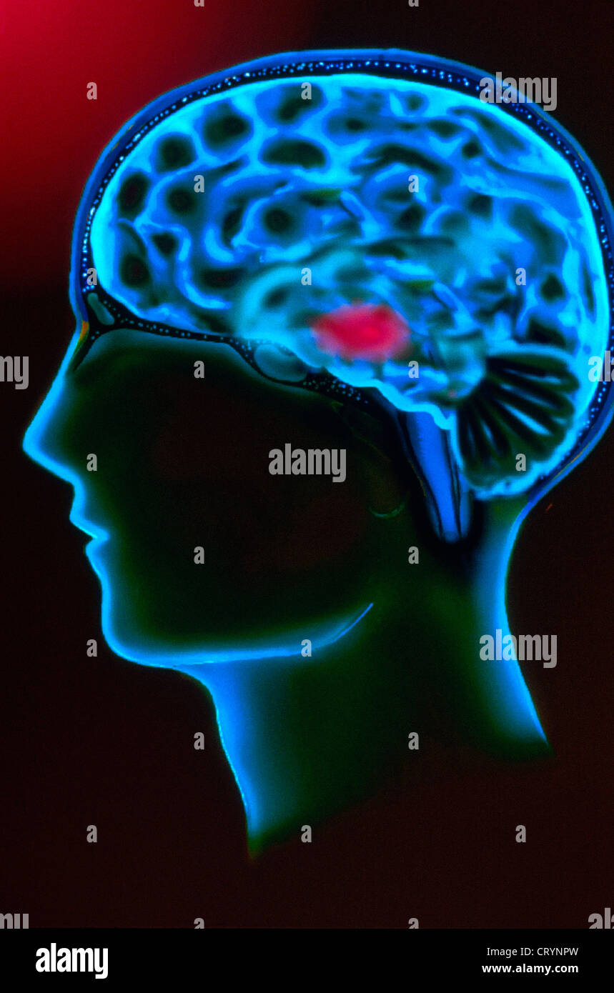 Auditory areas hi-res stock photography and images - Alamy