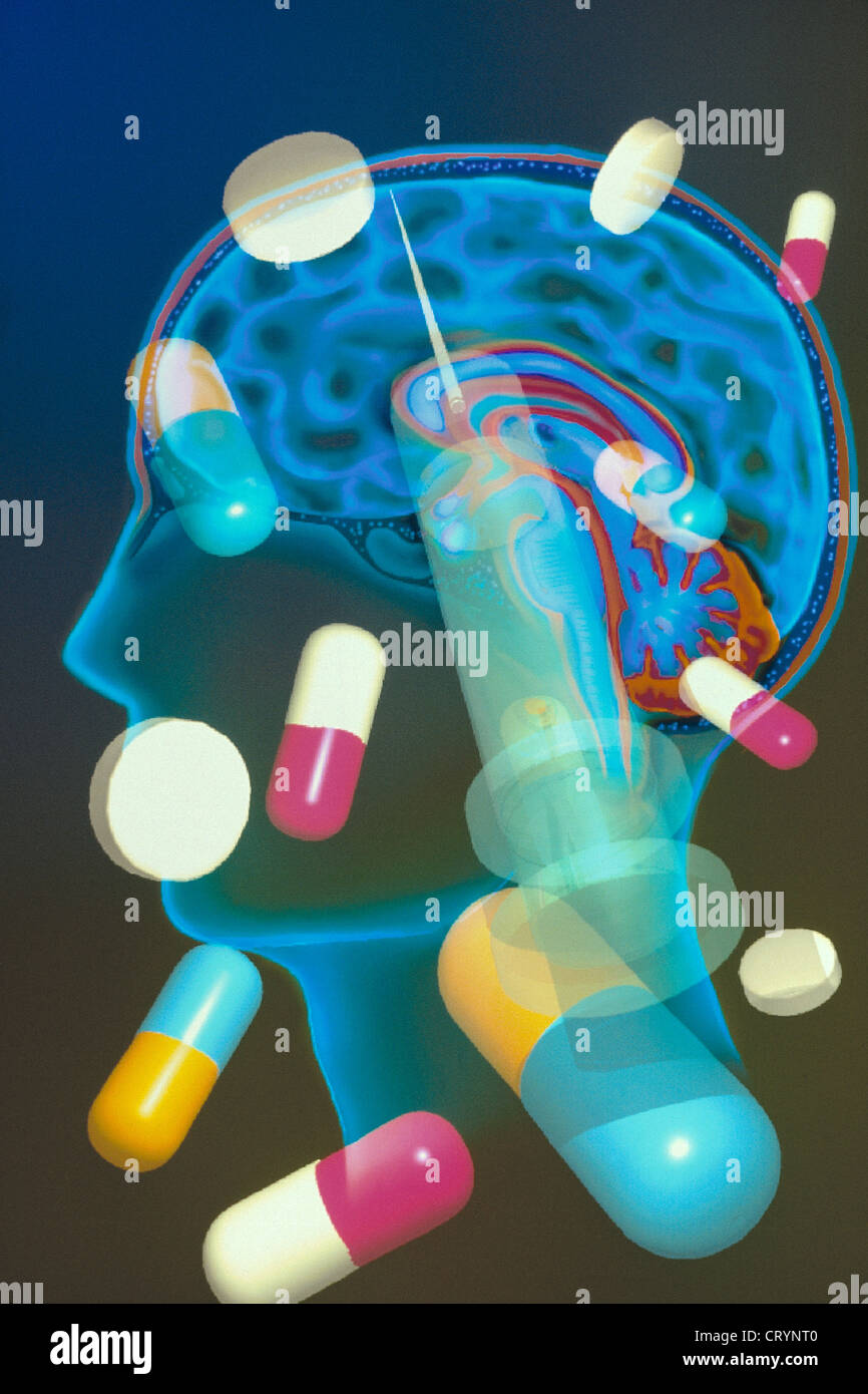 Drugs and the brain hi-res stock photography and images - Alamy