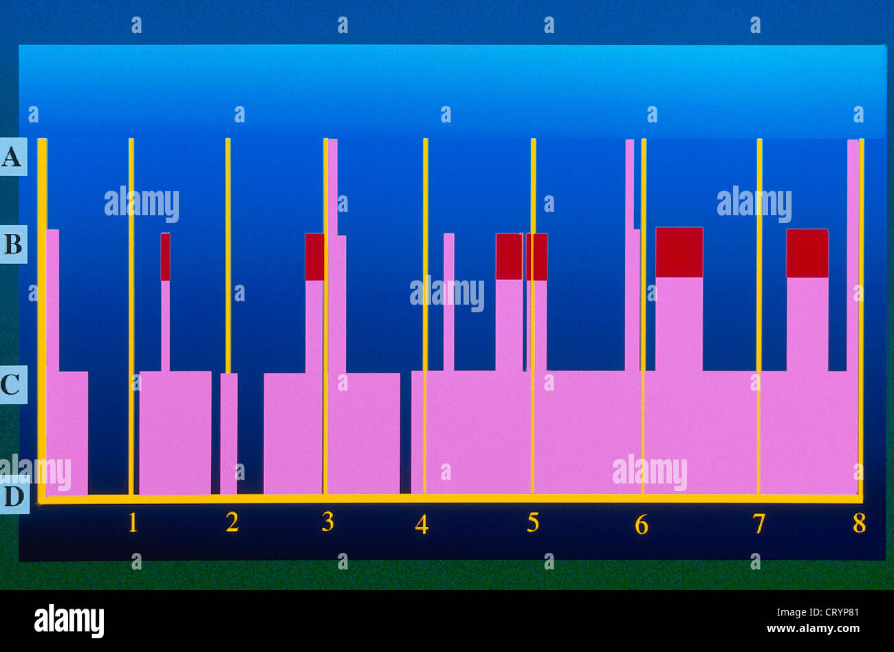 STUDY OF SLEEP Stock Photo - Alamy