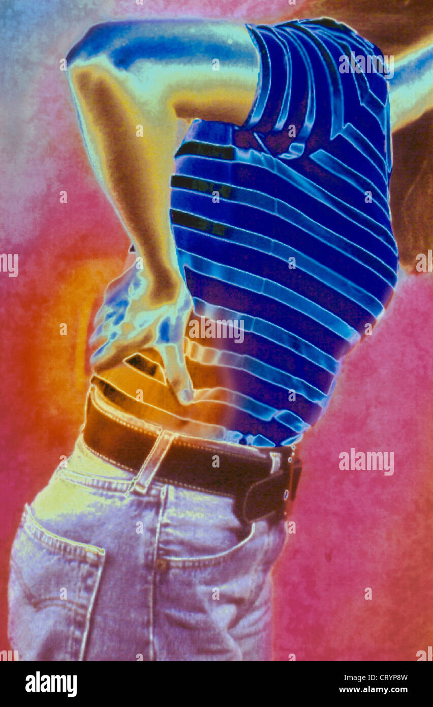 LOWER BACK PAIN, ILLUSTRATION Stock Photo - Alamy