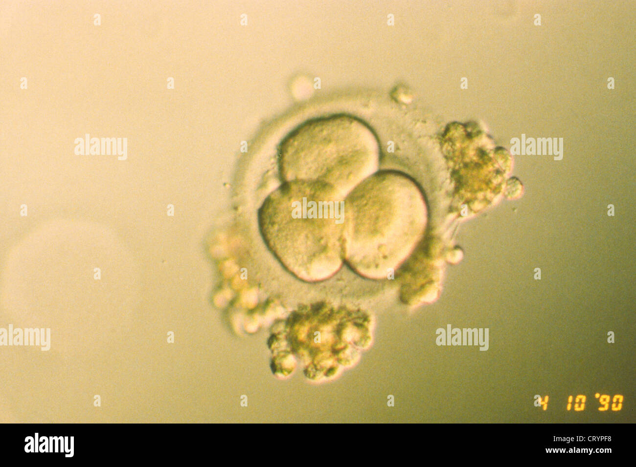 Embryo fertilization micrograph hi-res stock photography and images - Alamy