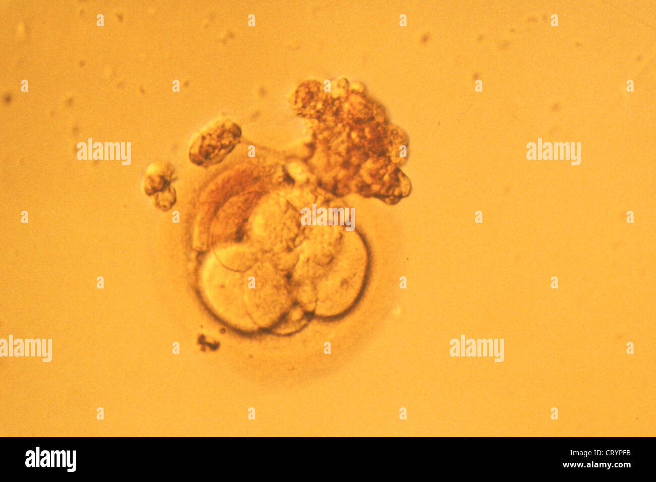 Blastula embryo hi-res stock photography and images - Alamy