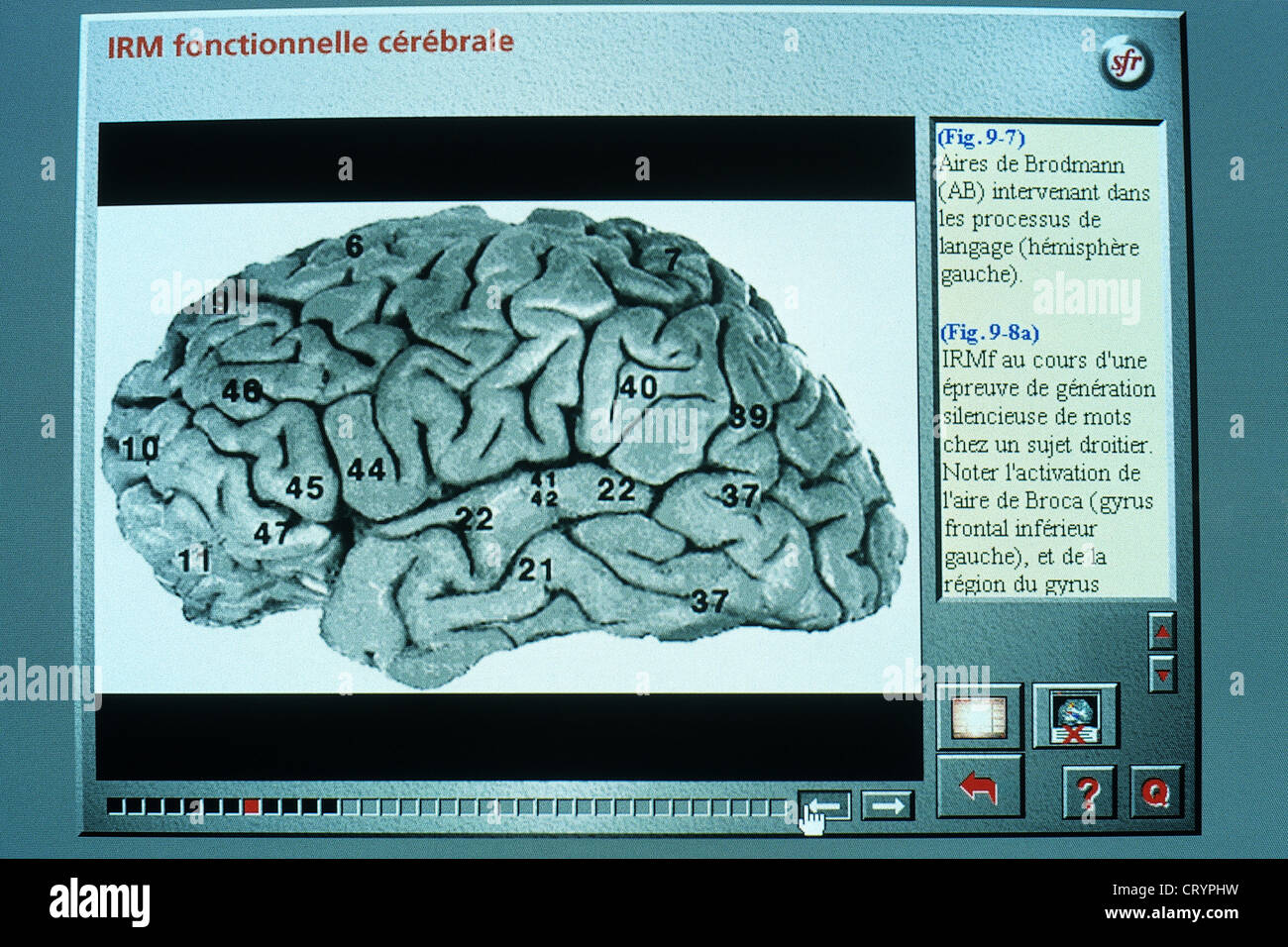 Brodmann brain areas hi-res stock photography and images - Alamy