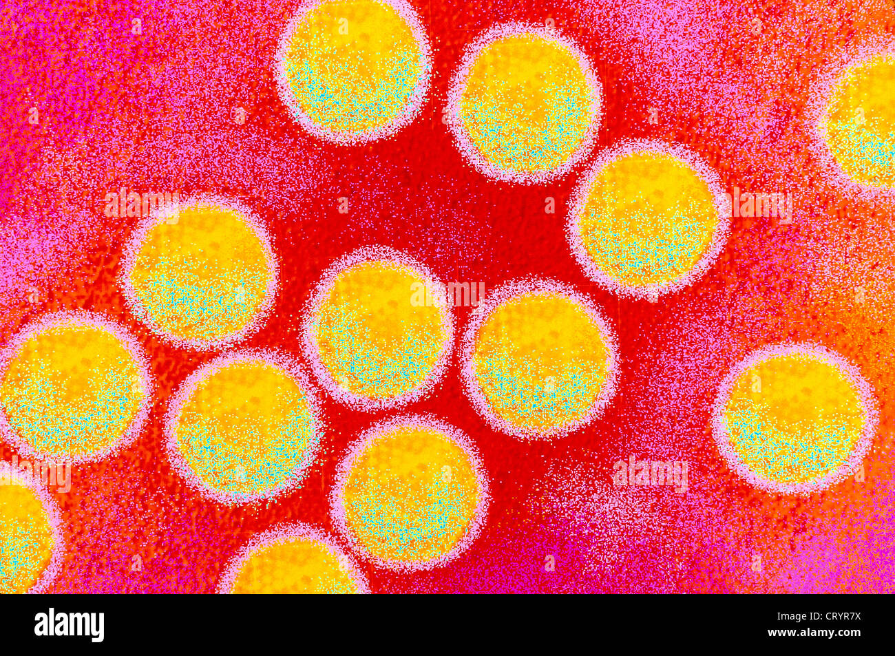 Adenovirus microscopy hi-res stock photography and images - Alamy