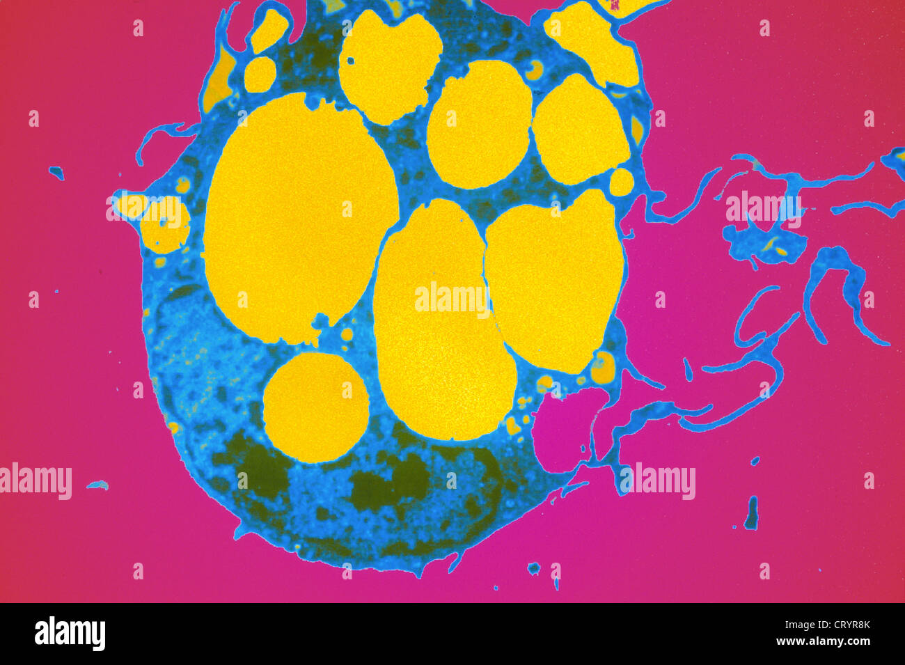 Fat cells micrograph hi-res stock photography and images - Alamy