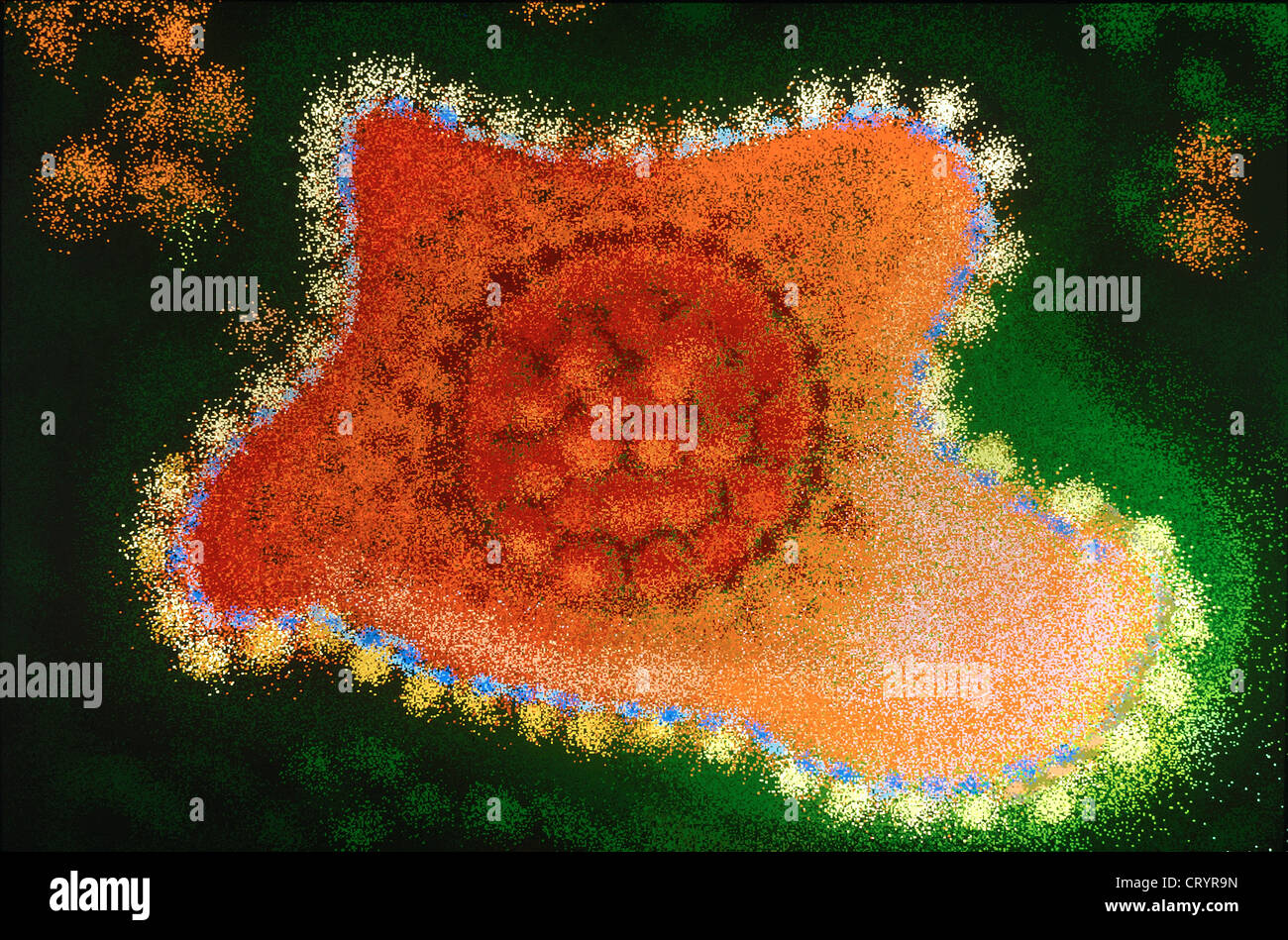 Varicella micrograph hi-res stock photography and images - Alamy