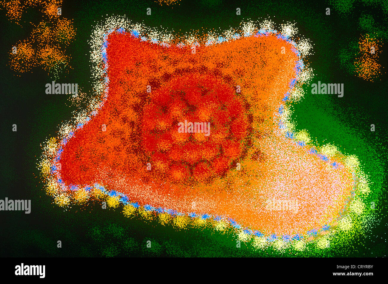 HERPES SIMPLEX VIRUS Stock Photo - Alamy