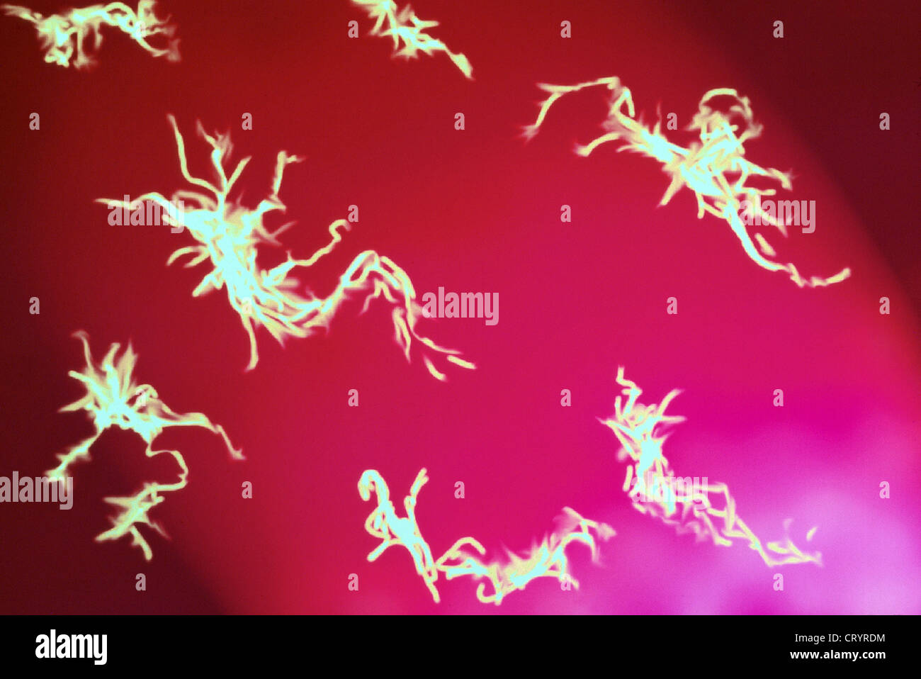 Tuberculoses hi-res stock photography and images - Alamy