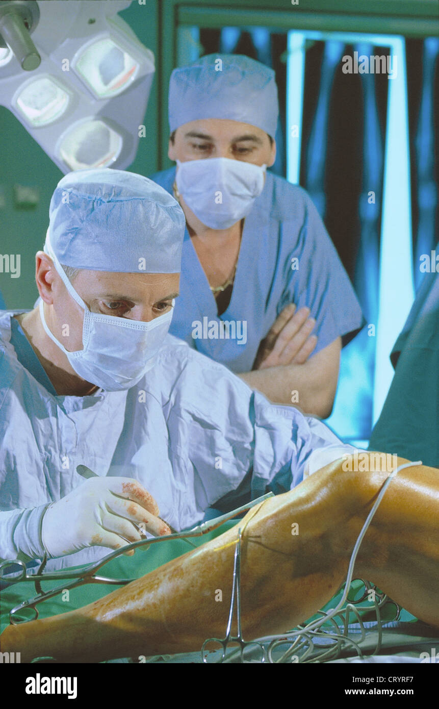 VARICOSE VEIN, SURGERY Stock Photo - Alamy