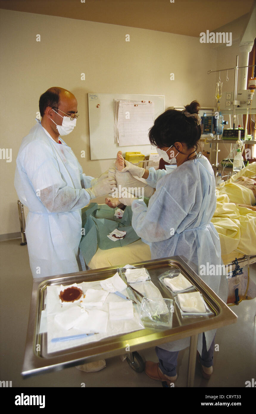 DECUBITUS ULCER, TREATMENT Stock Photo - Alamy