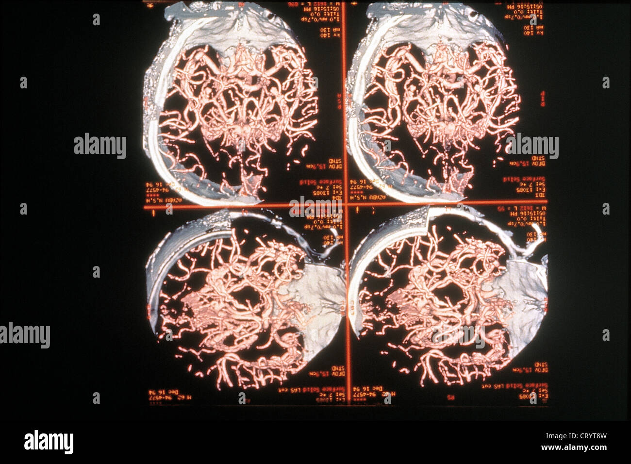 Brain imaging systems hi-res stock photography and images - Alamy