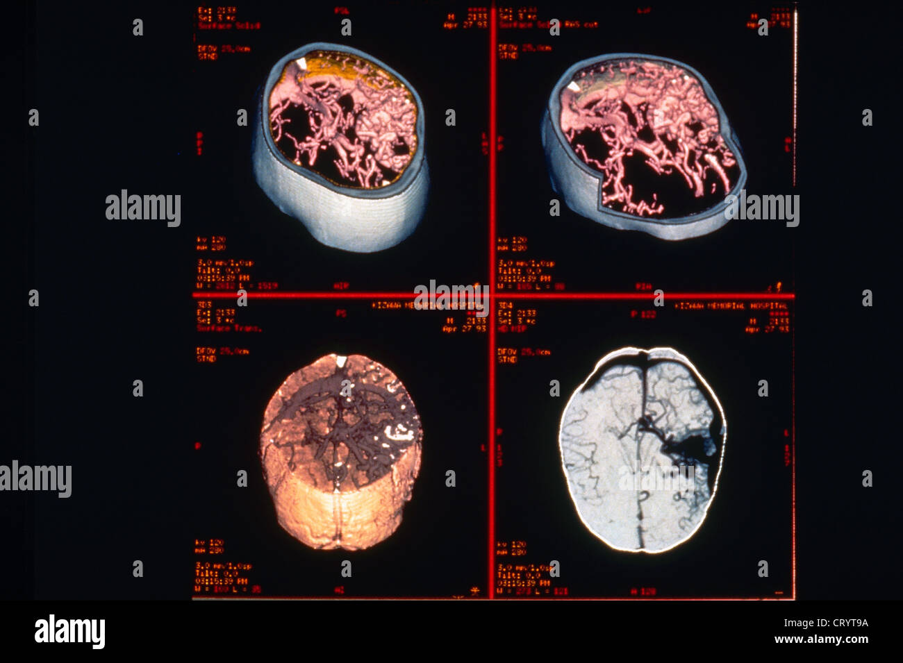 3 d scanner hi-res stock photography and images - Alamy