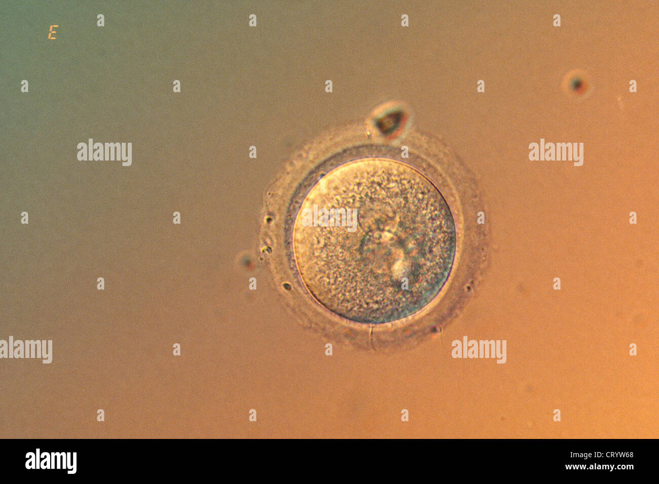 Embryo fertilization micrograph hi-res stock photography and images - Alamy