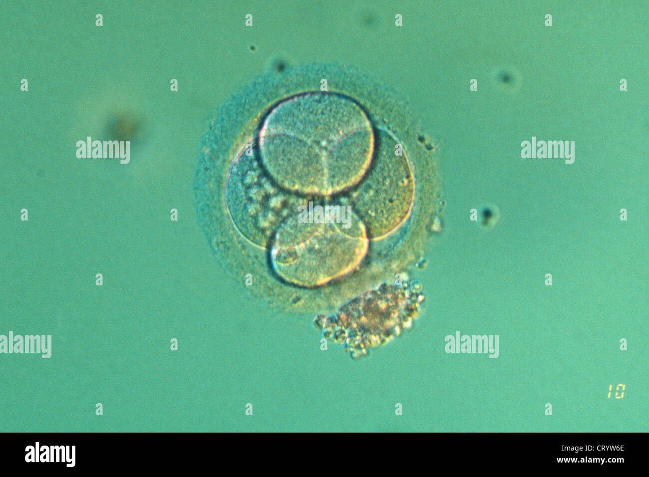 Blastula embryo hi-res stock photography and images - Alamy