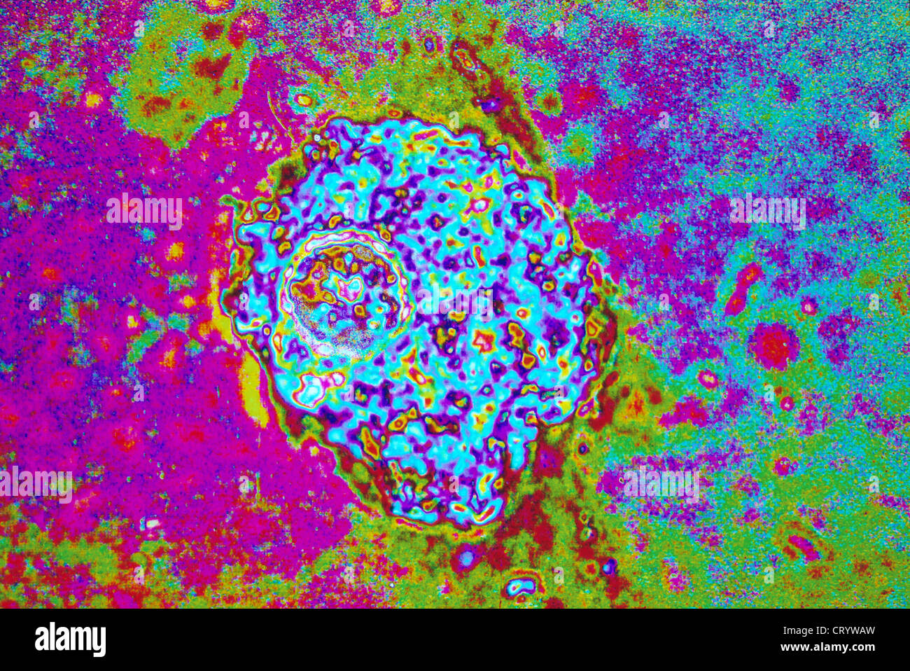 Ameba hi-res stock photography and images - Alamy