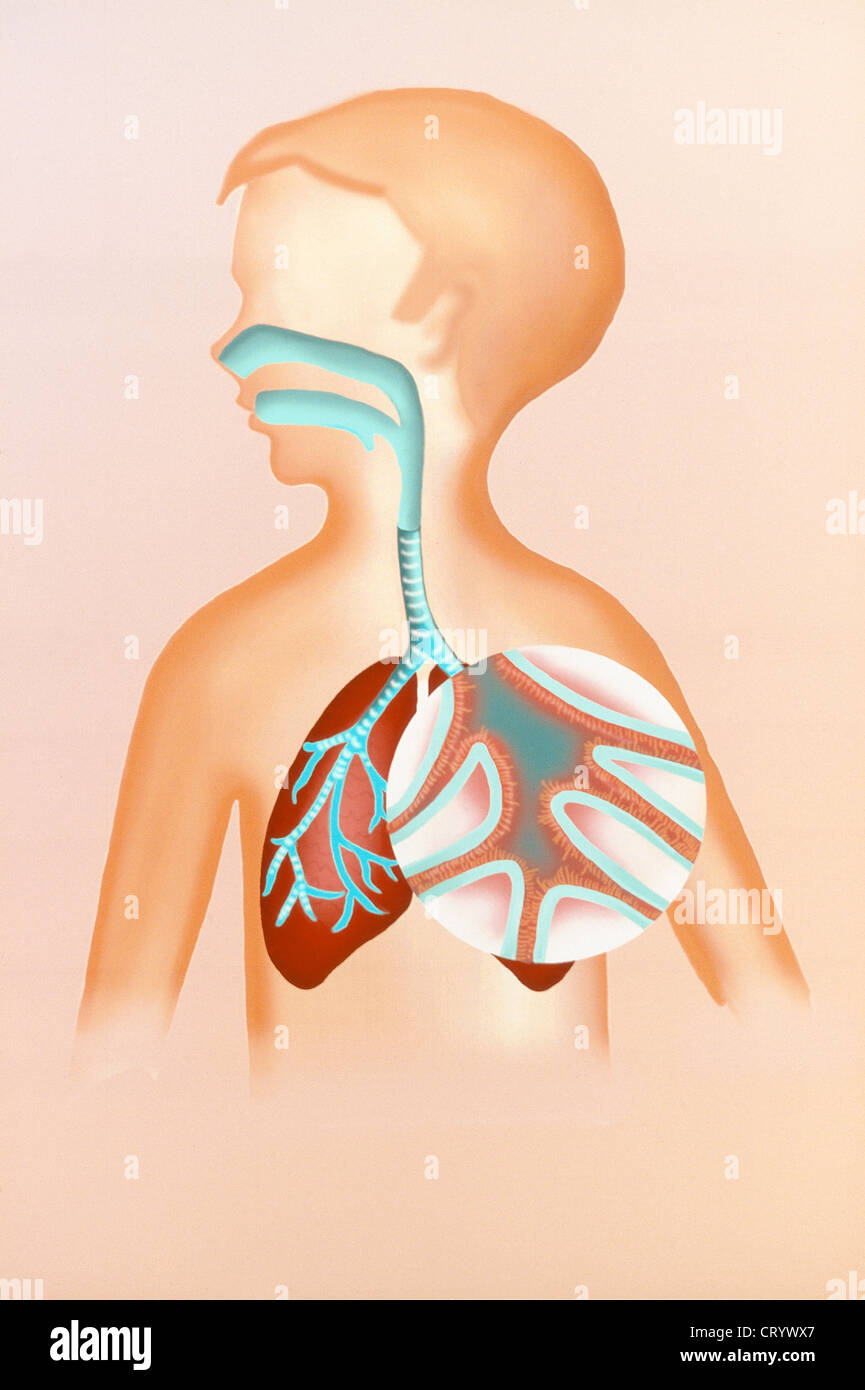 Bronchiolitis High Resolution Stock Photography and Images - Alamy