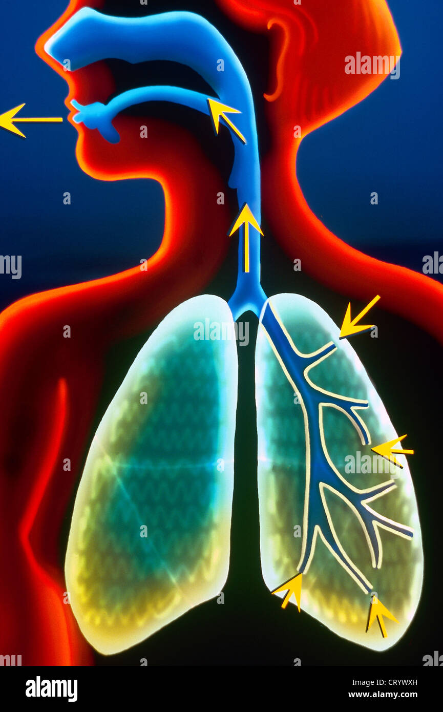 Pharyngeal aspiration hi-res stock photography and images - Alamy