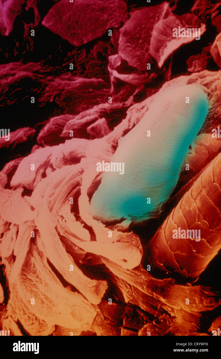 Demodex mites examination hi-res stock photography and images - Alamy