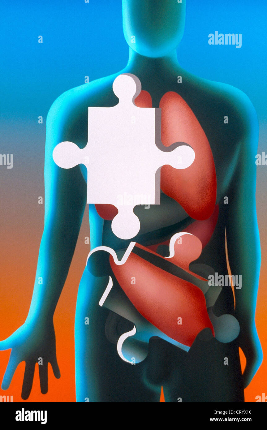 LUNG TRANSPLANT, DRAWING Stock Photo - Alamy