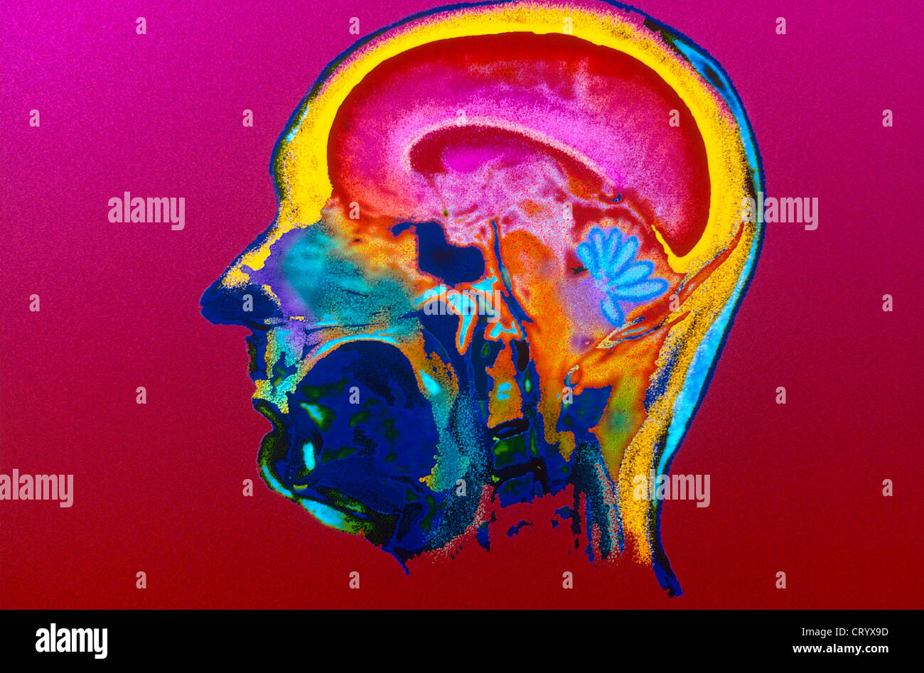 Healthy brain scan hi-res stock photography and images - Alamy