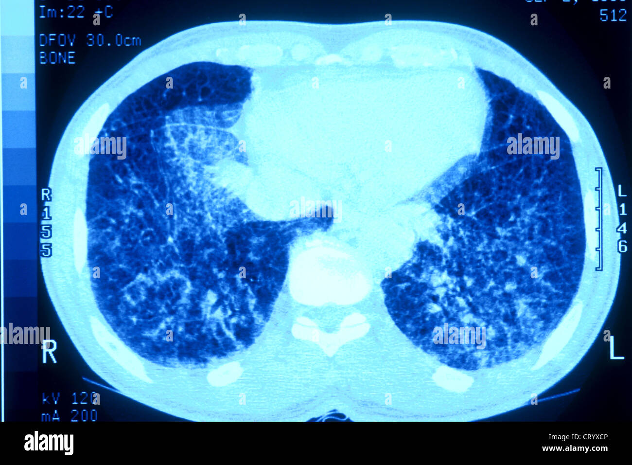Respiratory system photos hi-res stock photography and images - Alamy