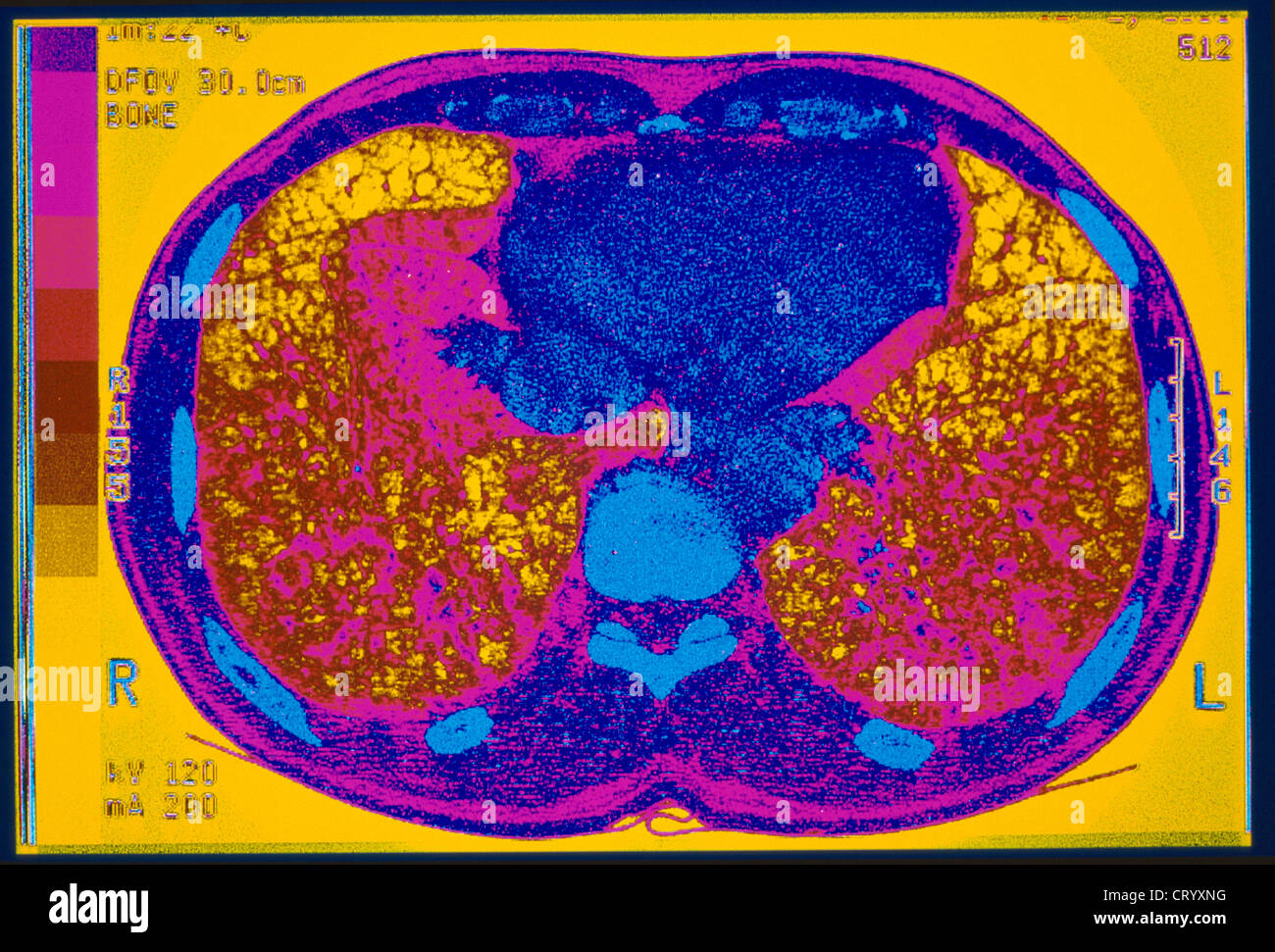 Pneumological examination hi-res stock photography and images - Alamy