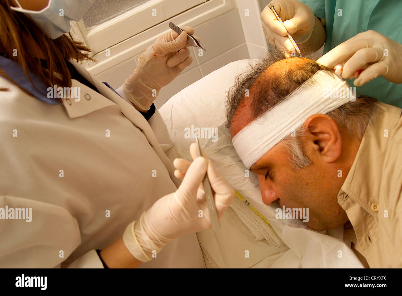 IMPLANT HAIR SURGERY Stock Photo - Alamy