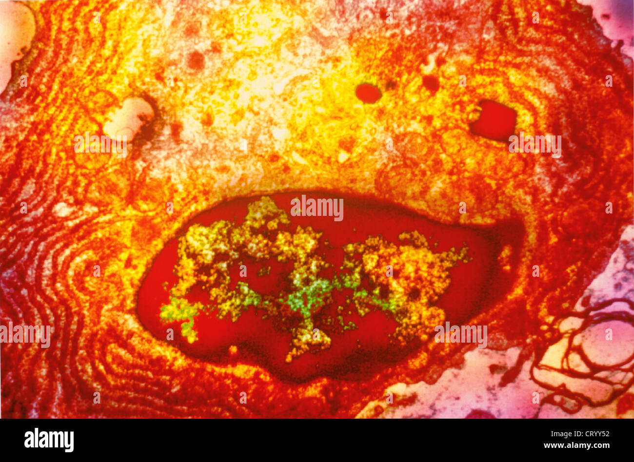 Plasmocytes hi-res stock photography and images - Alamy