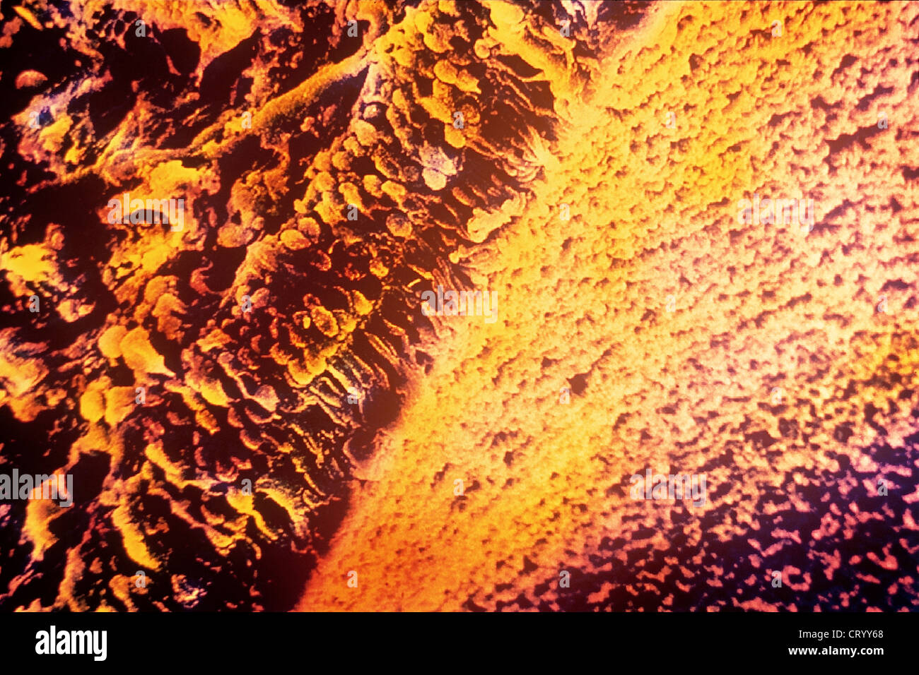 Retinal pigment epithelium hi-res stock photography and images - Alamy