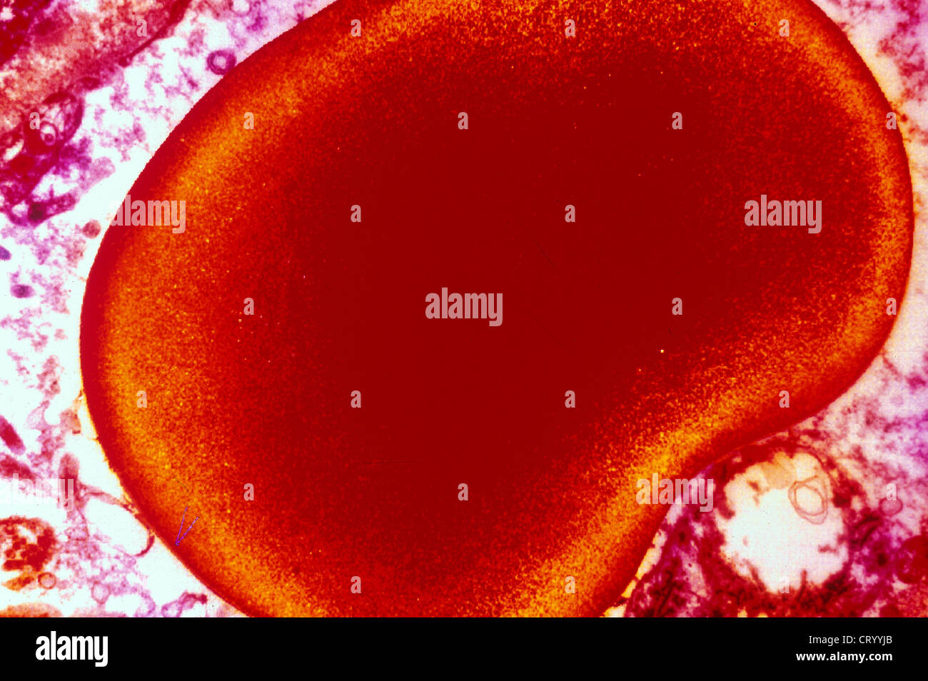 RED BLOOD CELL, TEM Stock Photo - Alamy