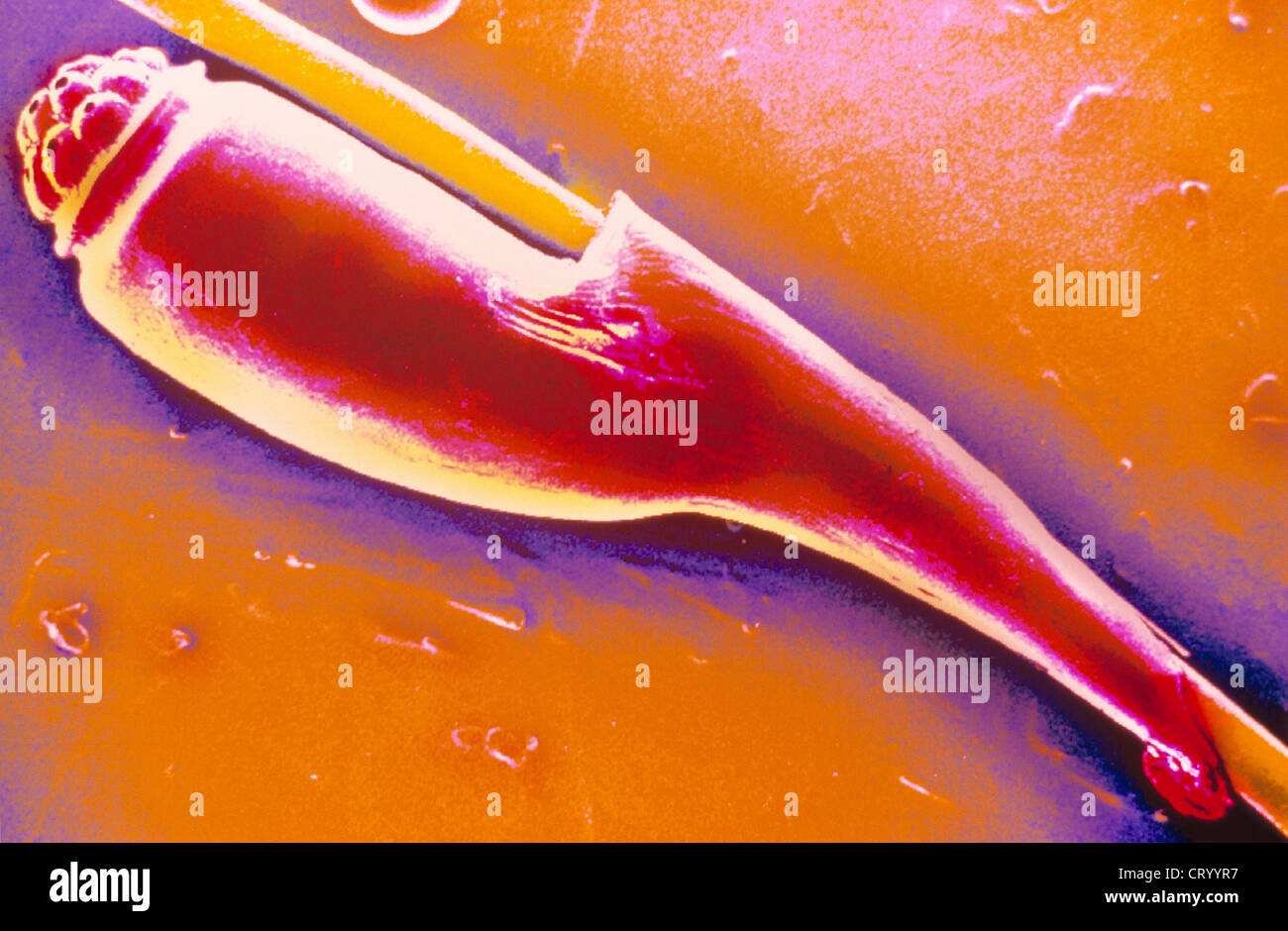 LOUSE NIT, SEM Stock Photo - Alamy