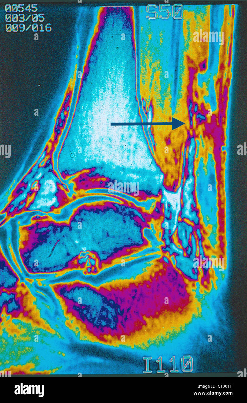 Trauma ankle inspect hi-res stock photography and images - Alamy