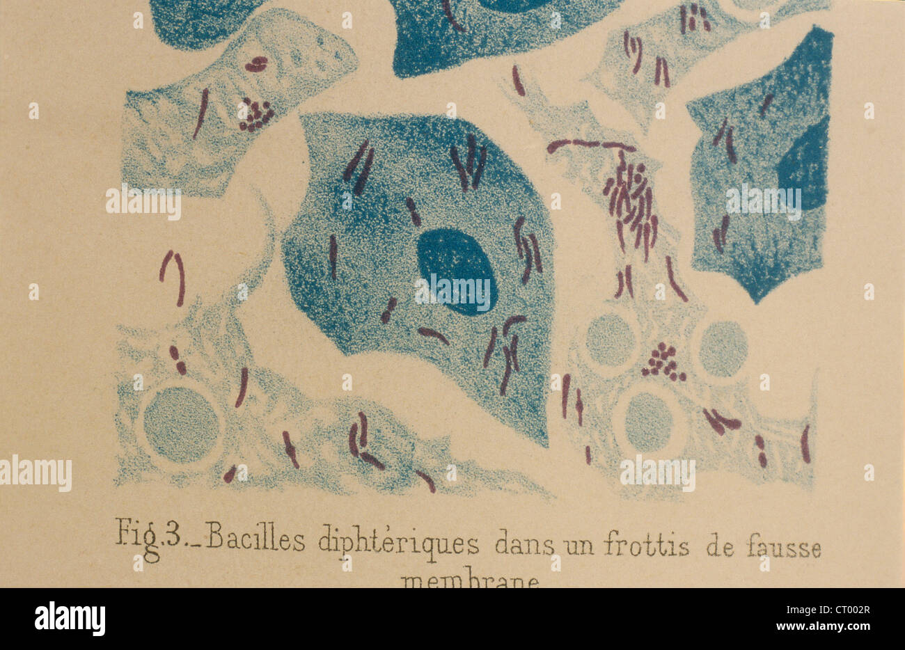 Corynebacterium Diphtheriae High Resolution Stock Photography and ...