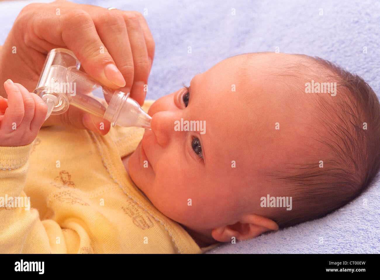 INFANT WITH RHINITIS Stock Photo - Alamy