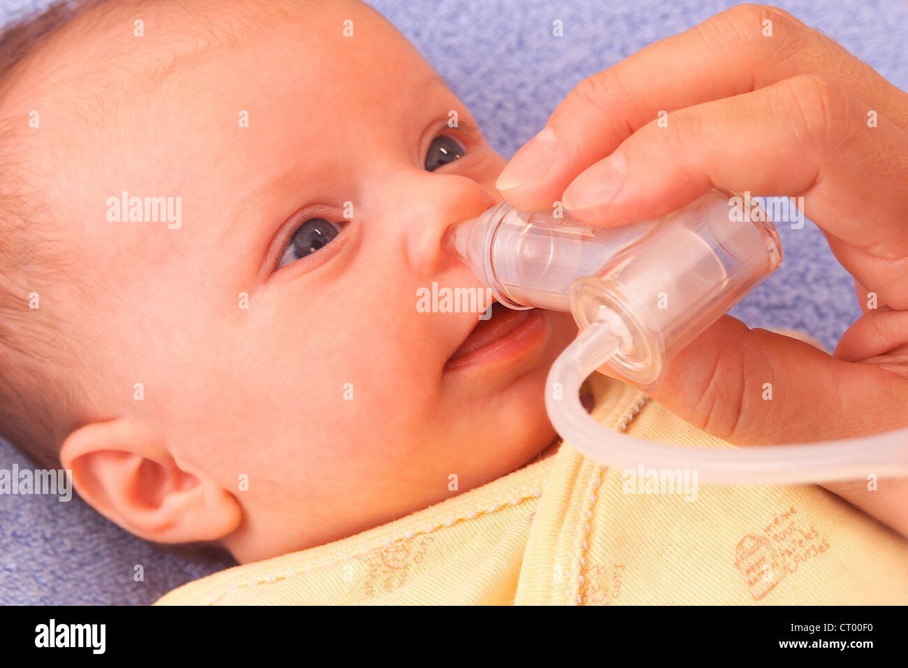 INFANT WITH RHINITIS Stock Photo - Alamy