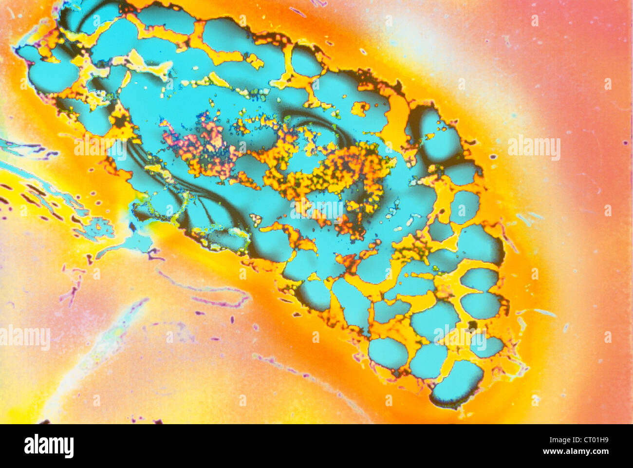 Mast cell micrograph hi-res stock photography and images - Alamy