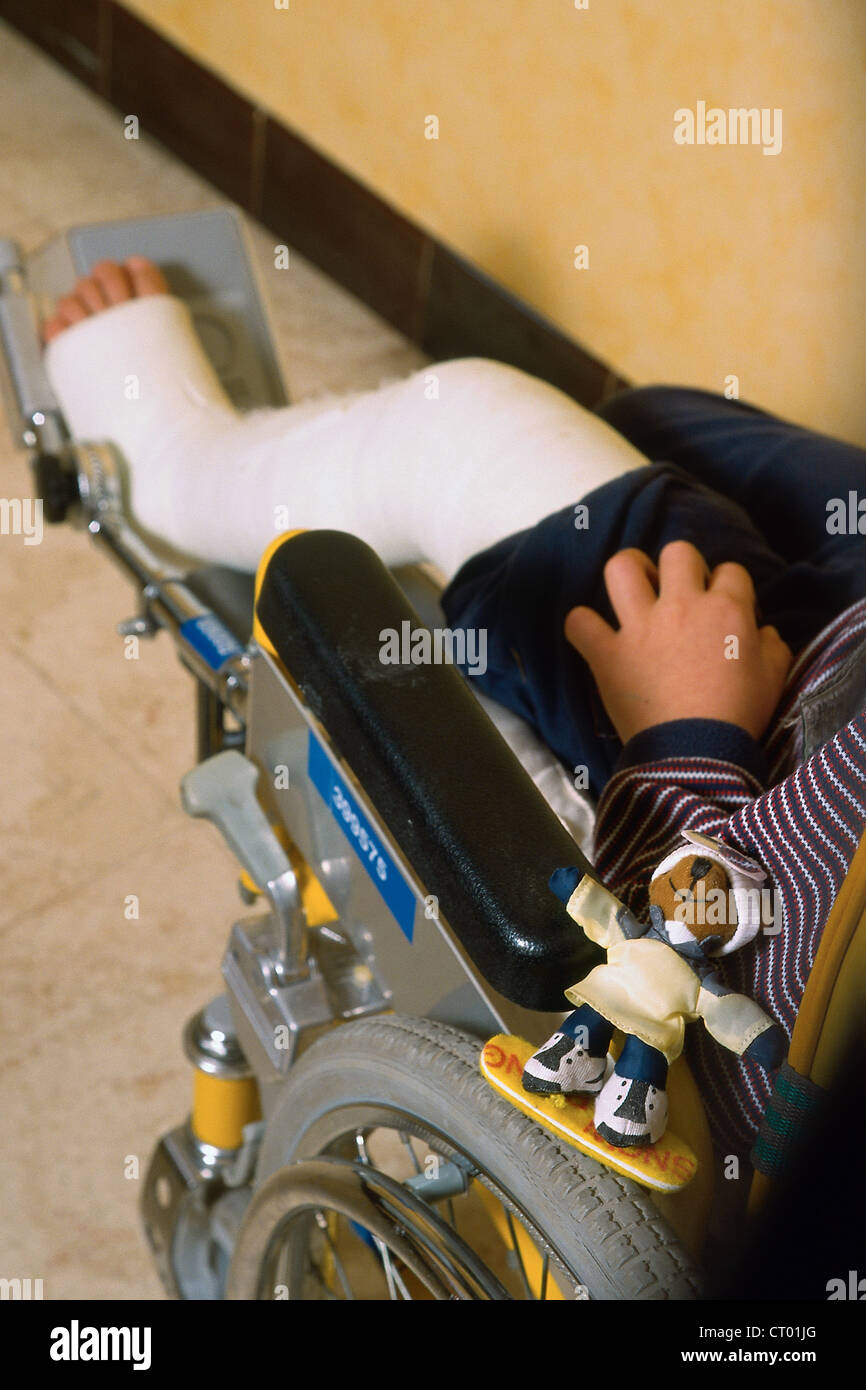 PLASTER CAST Stock Photo - Alamy PLASTER CAST Stock Photo - Alamy