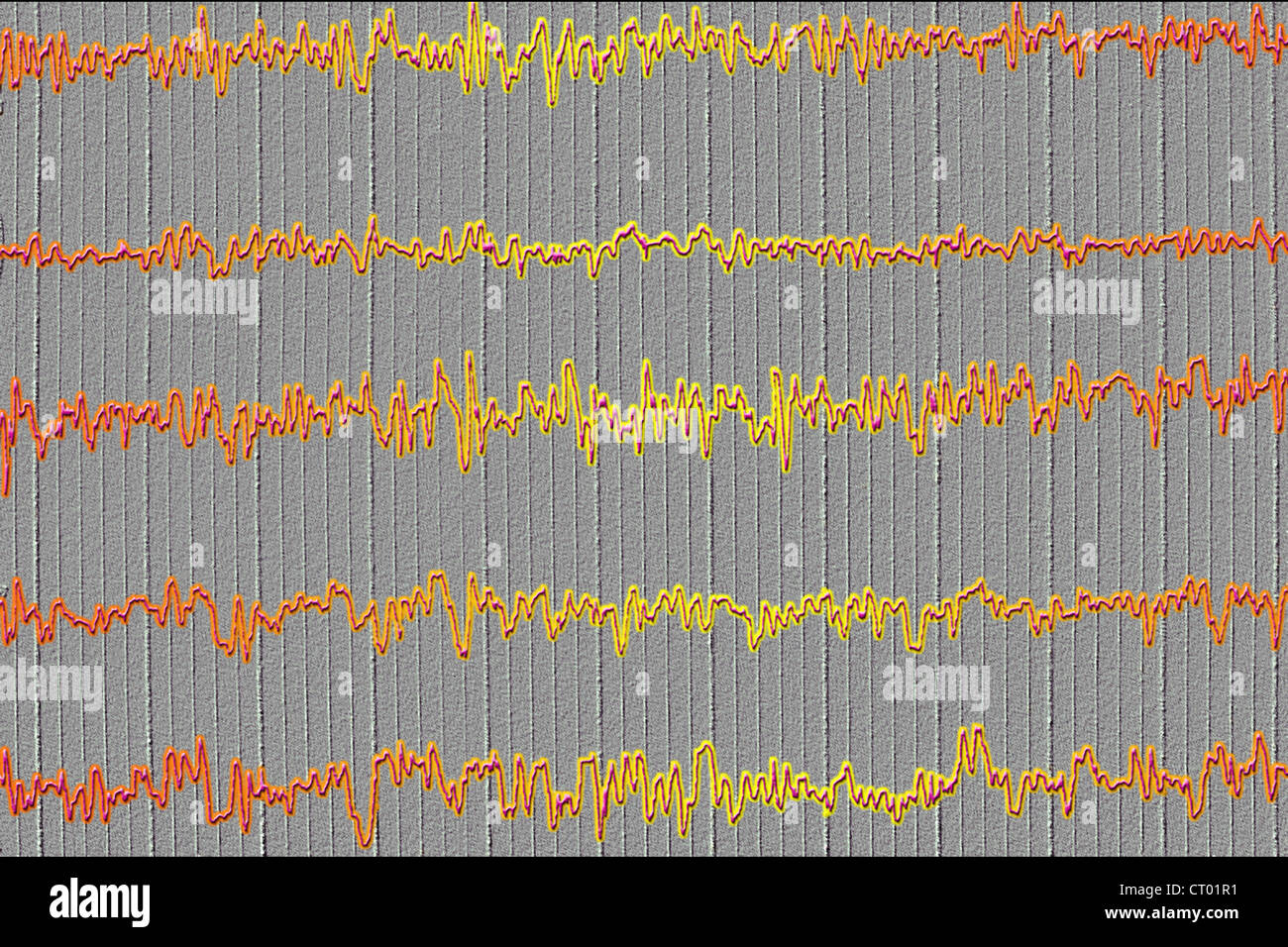Eeg imaging hi-res stock photography and images - Alamy
